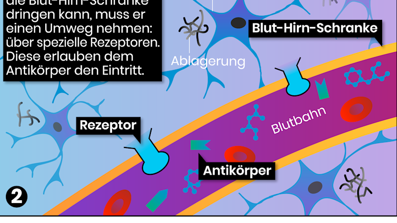 So funktioniert der Brain-Shuttle-Ansatz | The Pioneer